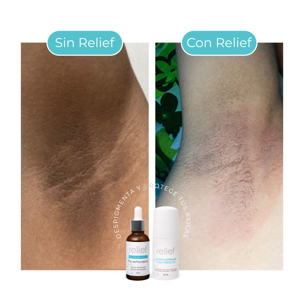 Aclara axilas con el kit despigmentante de piel y antitranspirante | Relief