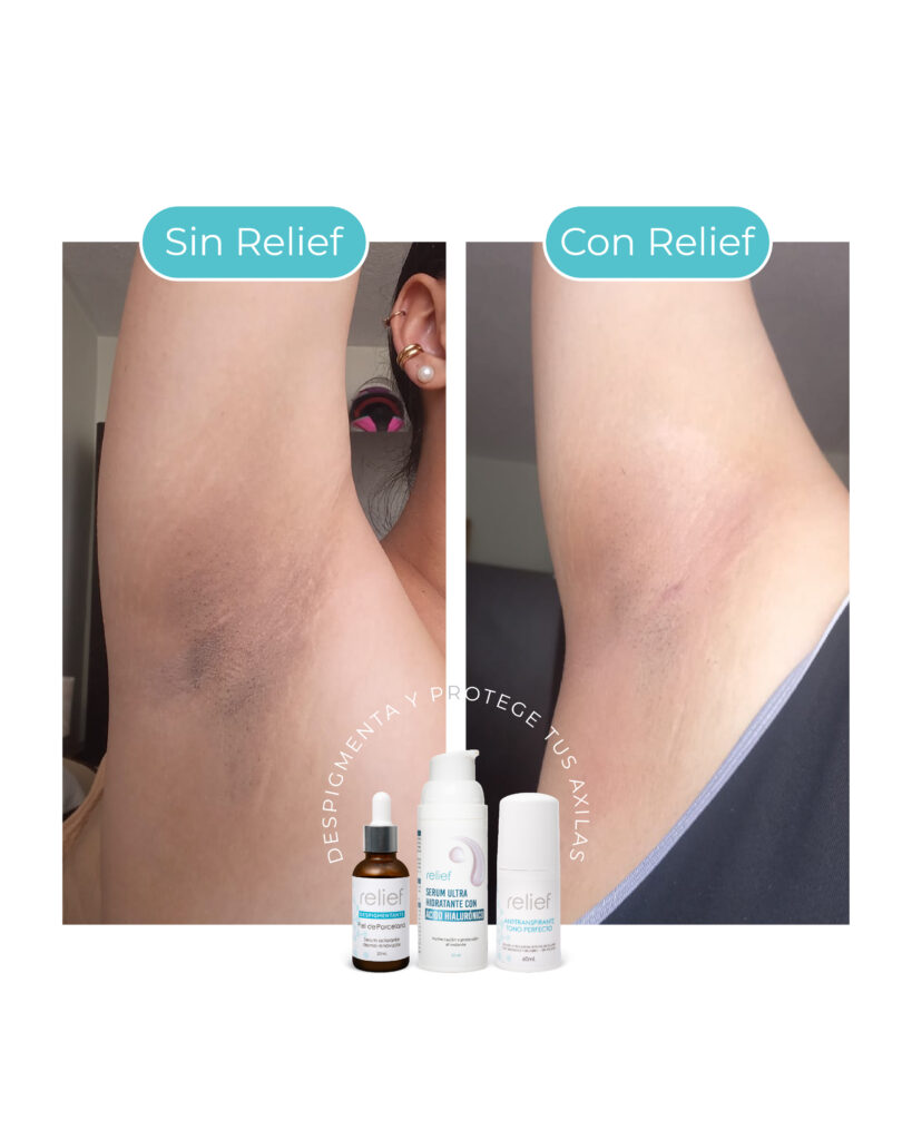 Kit axilas perfectas | Relief